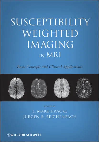Susceptibility Weighted Imaging in MRI. Basic Concepts and Clinical ...